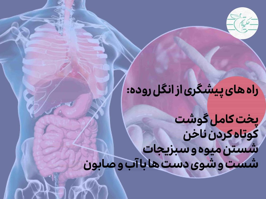 علائم و درمان انگل در بزرگسالان - عطاری آنلاین حکیم باشیم